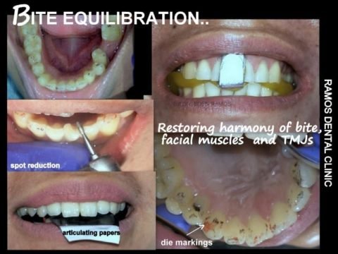 TMJ Specialist in Angeles City - Ramos Dental Clinic